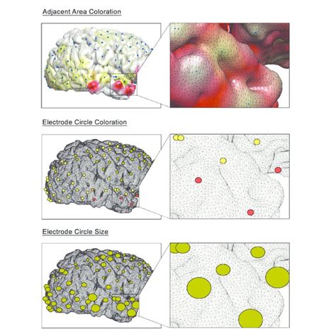 Common Methods For Displaying Intracranial Eeg Data On A Cortical