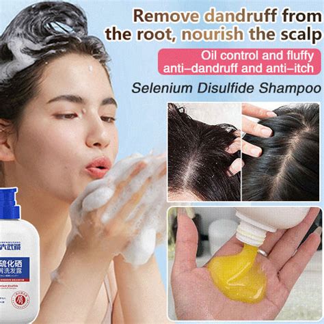 Damaino1 Miyamoto Musashi Selenium Disulfide Shampoo Lazada Ph