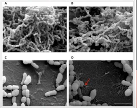 4 1 Explain The Following For S Mutans Metabolism Epidemiology Pathogenesis Prevention And