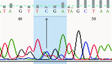 dna sequencing of ac genotype patient download scientific diagram