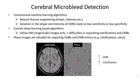 Cerebral Microbleed Detection Using Susceptibility Weighted Imaging And