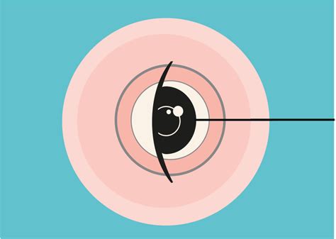 Get Started With Wirepas Mesh Development