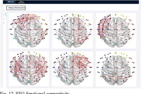 Figure 12 From A Multimodal Fusion Depression Recognition Assisted Decision Making System Based