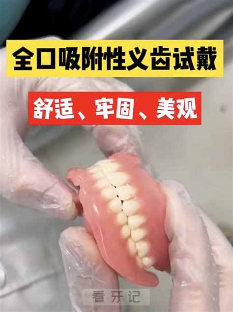 牙床萎缩能做什么假牙吸附式假牙和种植牙哪个更好 看牙记网
