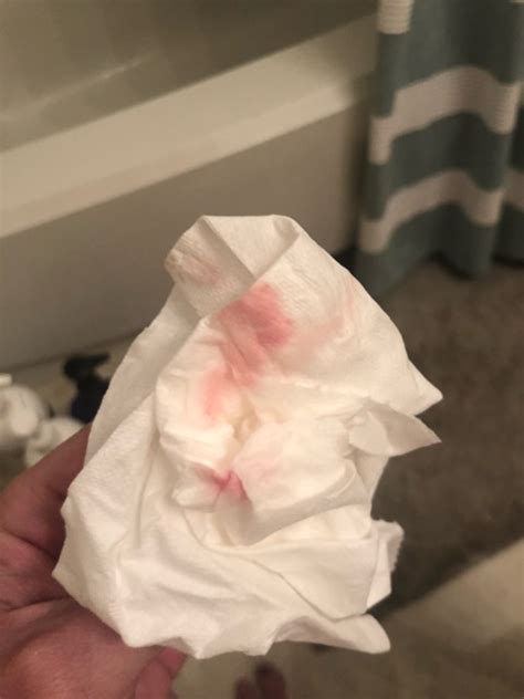 7 Dpo Implantation Bleeding 😍🤗😃😃😃 Glow Community