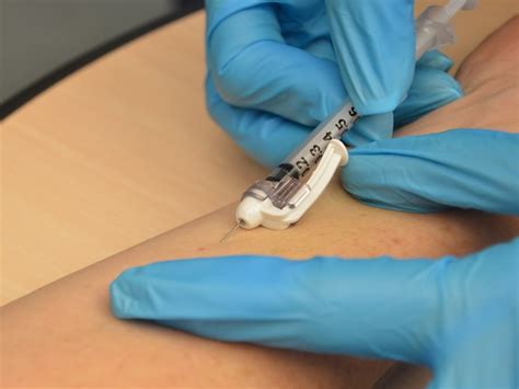 25 Interesting Facts About Intradermal Injection Worlds Facts