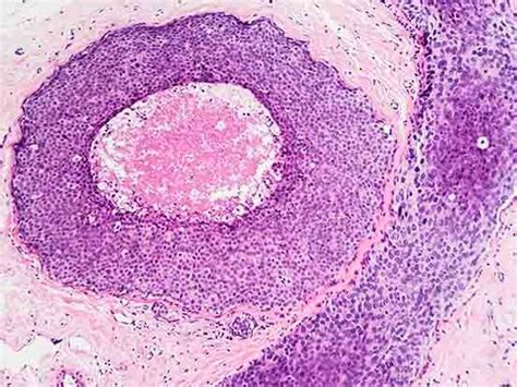 How Ffpe Skin Tissue Slides Advance Dermatology And Skin Cancer Studies