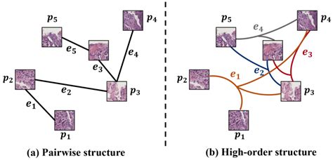 논문 리뷰 Dynamic Hypergraph Representation For Bone Metastasis Cancer Analysis