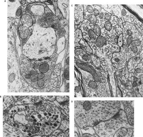 Overview Of The Microstructure Of The Nervous System Neupsy Key