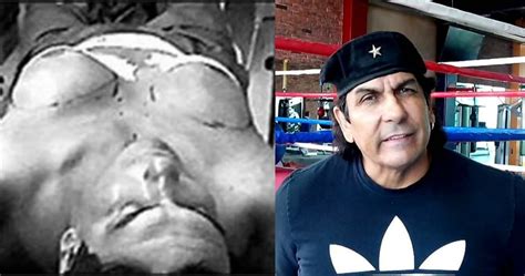 Most Bizarre Medical Blunders To Have Ever Happened