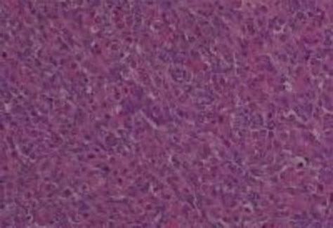 Novus Biologicals Human Ovary Tissue Microarray Metastatic Cancer