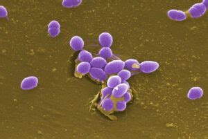 Enterococcus Faecalis A Comprehensive Guide