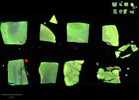 overall fluorescence quantification analysis using qupath image analysis image sc forum