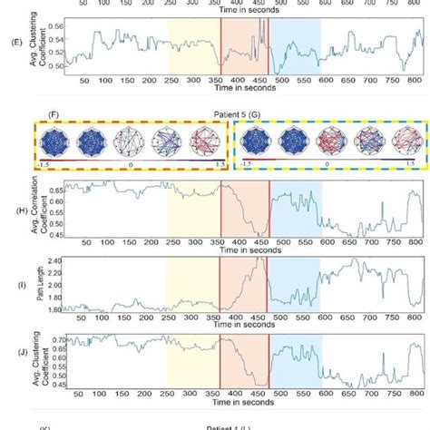 Functional Connectivity And Graph Theory Analysis A F K M O