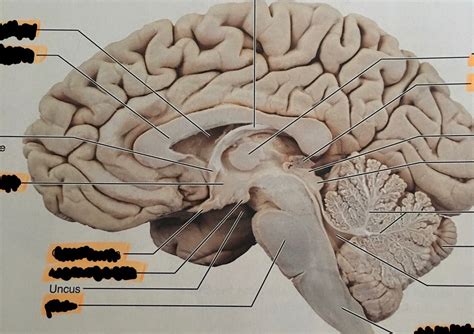 Photograph Of Diencephalon And Brain Stem Structures Lab 1 Diagram Quizlet