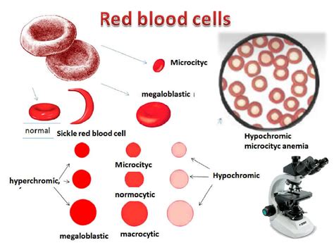 Complete Blood Count Red Blood Cell Morphology 40 Off