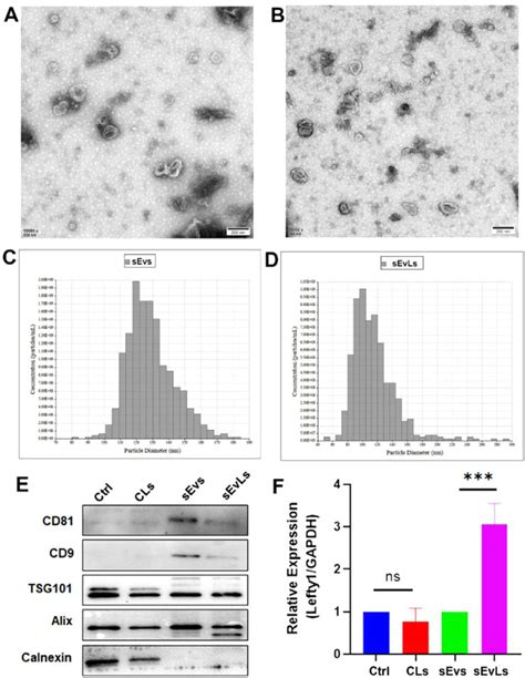 Characterization Of Sevs And Sevls A B Morphologies Of Sevs And