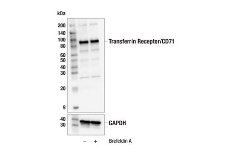 Transferrin Receptor Cd71 H68 4 Mouse Mab Cell Signaling Technology