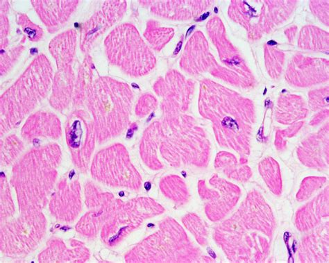 Cardiac Muscle Slide Cross Section