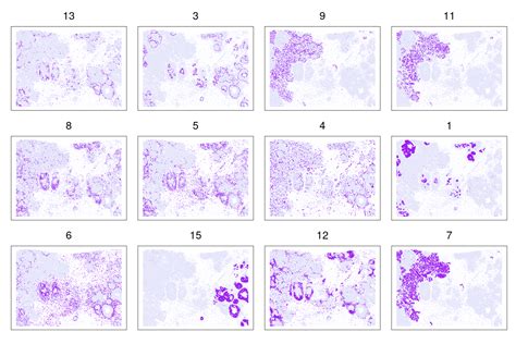 24 Clustering Orchestrating Spatial Transcriptomics Analysis With Bioconductor