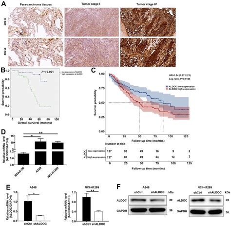 Aldoc Is Strongly Expressed In Nsclc A Aldoc Protein Patterns Were Download Scientific