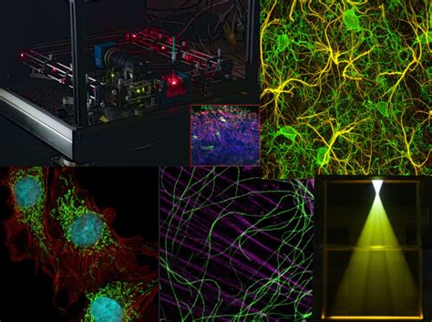 Nysdoh Imaging Workshop Deconvolution To Deep Learning