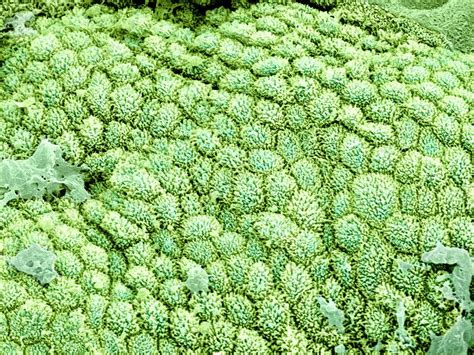 Gallbladder Surface Sem Stock Image C015 9612 Science Photo Library