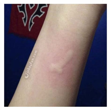 Joke4Fun Memes The Bug That Bit Me Is A Pervert