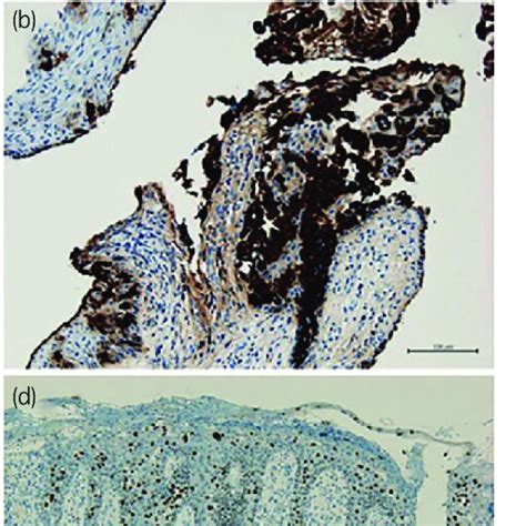 Erythema Of Labia Majora Download Scientific Diagram