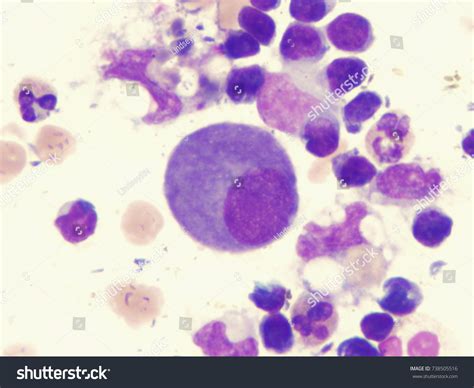 Mesothelial Cells