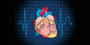 Stroke Volume Calculation Lone Star Neurology
