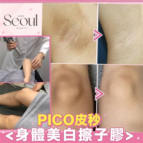 Pico 皮秒身體美白擦子膠 全身美白擊退瑕疵