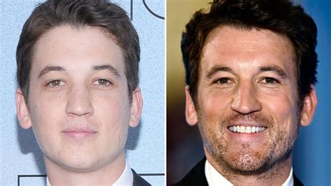 Miles Teller Good Genes Or Good Docs