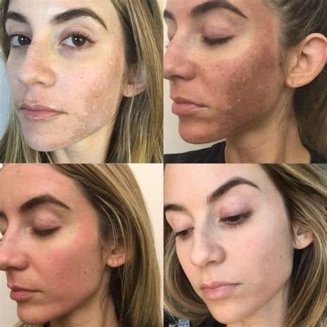 Pin On Beforeafter Nuskin