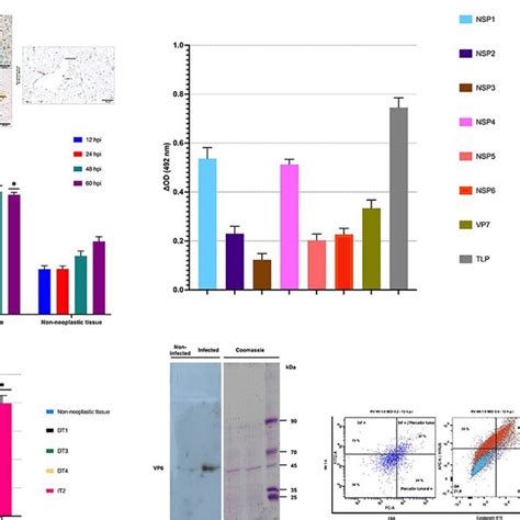 Expression Of Tumor Markers In Tissue Samples From Patients Diagnosed Download Scientific