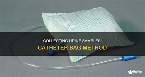 Collecting Urine Samples Catheter Bag Method Medshun