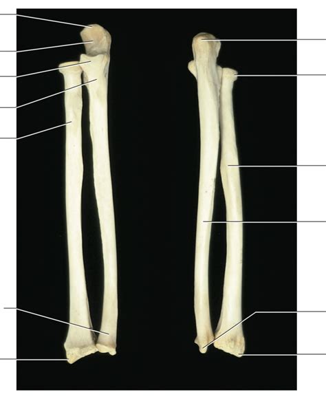 Radius And Ulna Diagram Quizlet