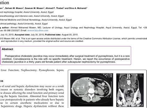 A And 1b Ct Scanning Showing Rt Pyonephrosis With Multiple Stones And