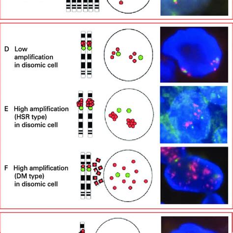 Epidermal Growth Factor Receptor Egfr Gene Amplification By Download Scientific Diagram
