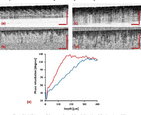 Figure 1 From Correlation Between Polarization Sensitive Optical