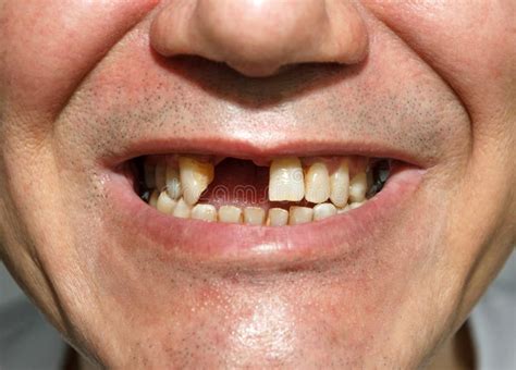 Smile Without Teeth Stock Image Image Of People Cheerful 68112913