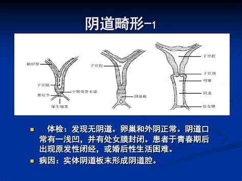 性器官畸形和两性畸形word文档在线阅读与下载无忧文档
