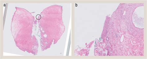 Benefits And Challenges Of Digital Pathology Use For Primary Diagnosis In Gynaecological