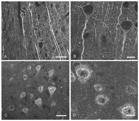 Localization Of Ala Isoforms In The Dorsal Cerebral Cortex Sagittal