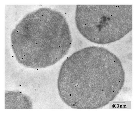 Ultrathin Sections Of Methanosarcina Mazei Dsm 3318 Formerly