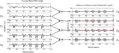 Figure 2 From Automated Diagnosis Of Epilepsy Using Key Point Based
