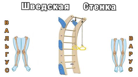 Упражнения ЛФК на Шведской Стенке ПЛОСКОСТОПИЕ ВАЛЬГУС ВАРУС у детей Youtube