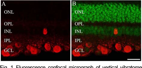 Figure 3 From Expansions Related To Ramanujan Series And Alike Semantic Scholar