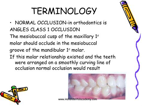 Occlusion Basics PPT