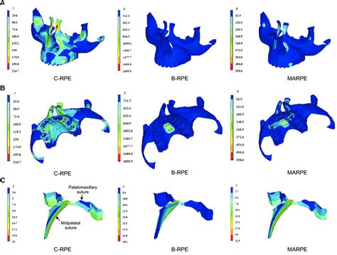 The Finite Element Model Showing The Von Mises Stress Distribution Over